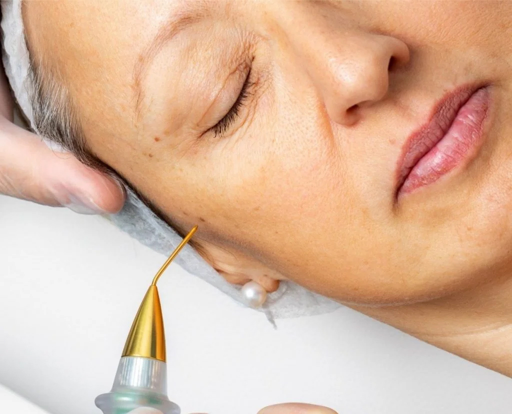 Jett Plasma Lift iSkinPure